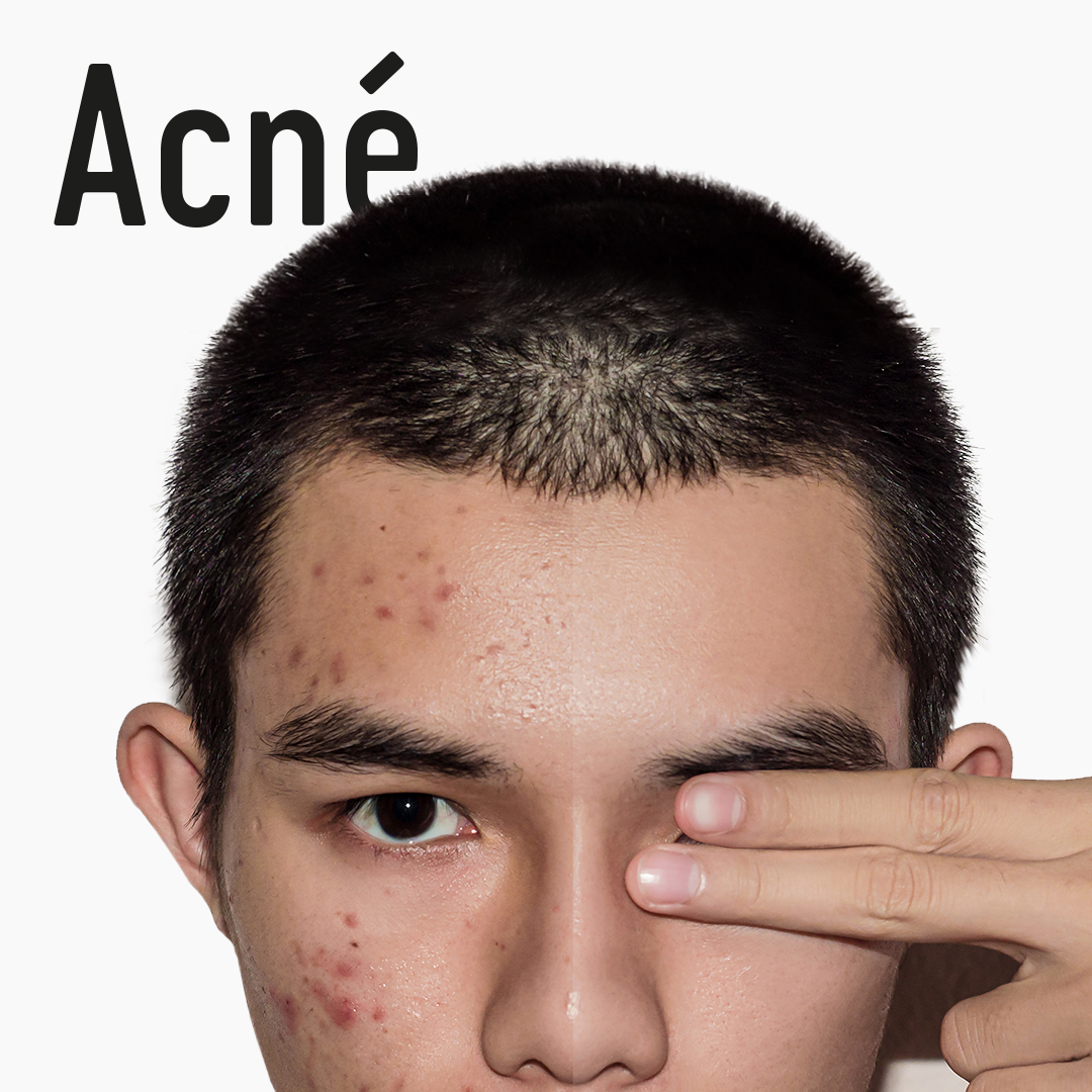 Touché Skincare - Touché Skincare Lab